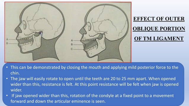 Temporomandibular Joint (Anatomy) | PPTX | Bone and Joint Conditions ...
