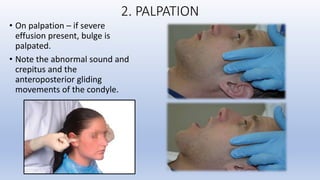 Temporomandibular Joint (Anatomy) | PPTX
