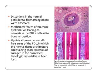 Biological Aspect on Orthodontic Tooth Movement | PPT