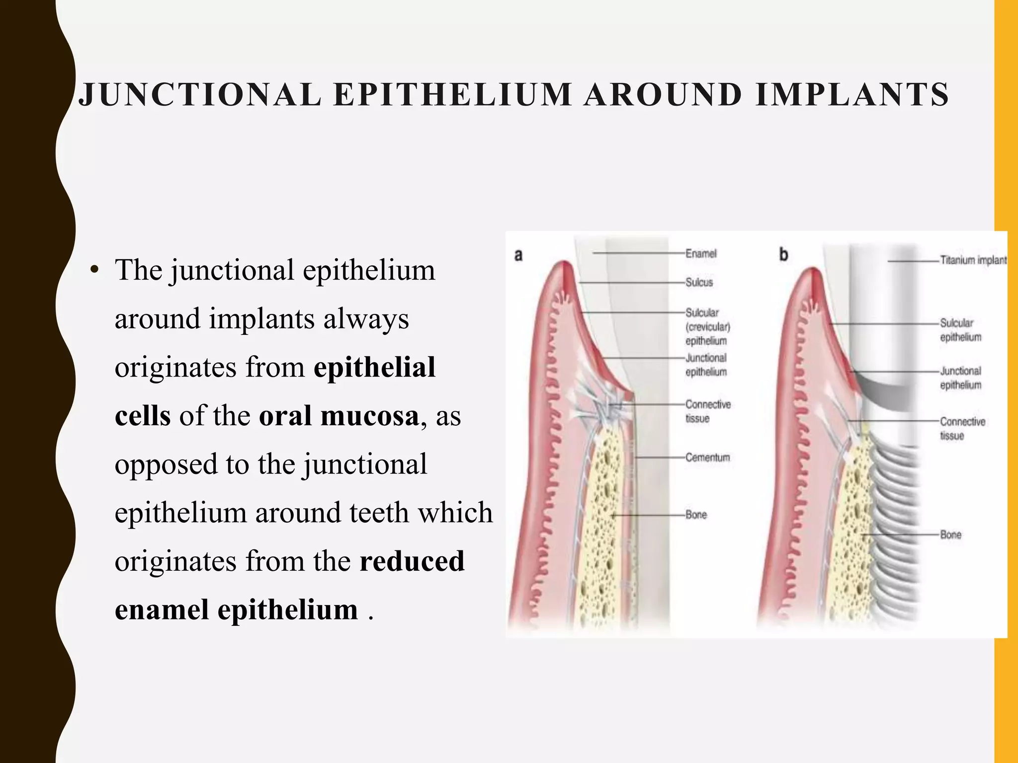 JUNCTIONAL EPITHELIUM | PPTX