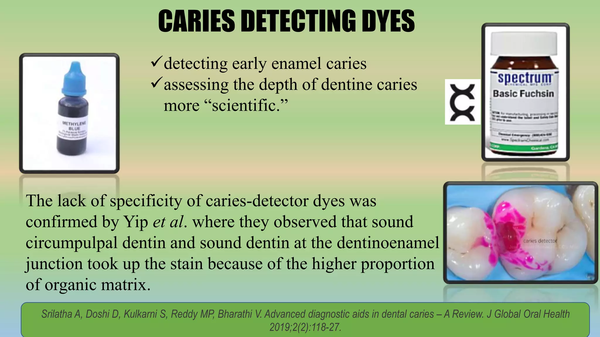 Recent advances in dental caries diagnosis | PPTX