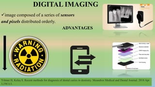 Recent advances in dental caries diagnosis | PPTX