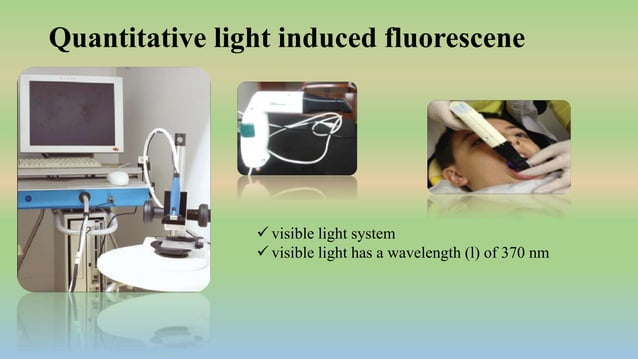 Recent advances in dental caries diagnosis | PPTX