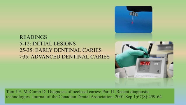 Recent advances in dental caries diagnosis | PPTX