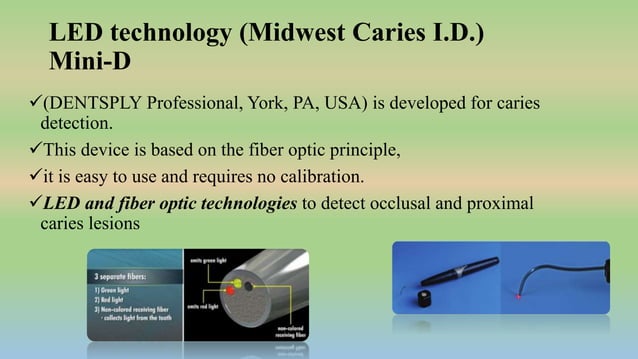 Recent advances in dental caries diagnosis | PPTX