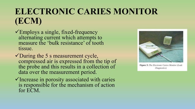 Recent advances in dental caries diagnosis | PPTX