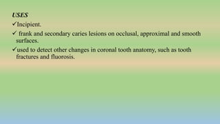 Recent advances in dental caries diagnosis | PPT