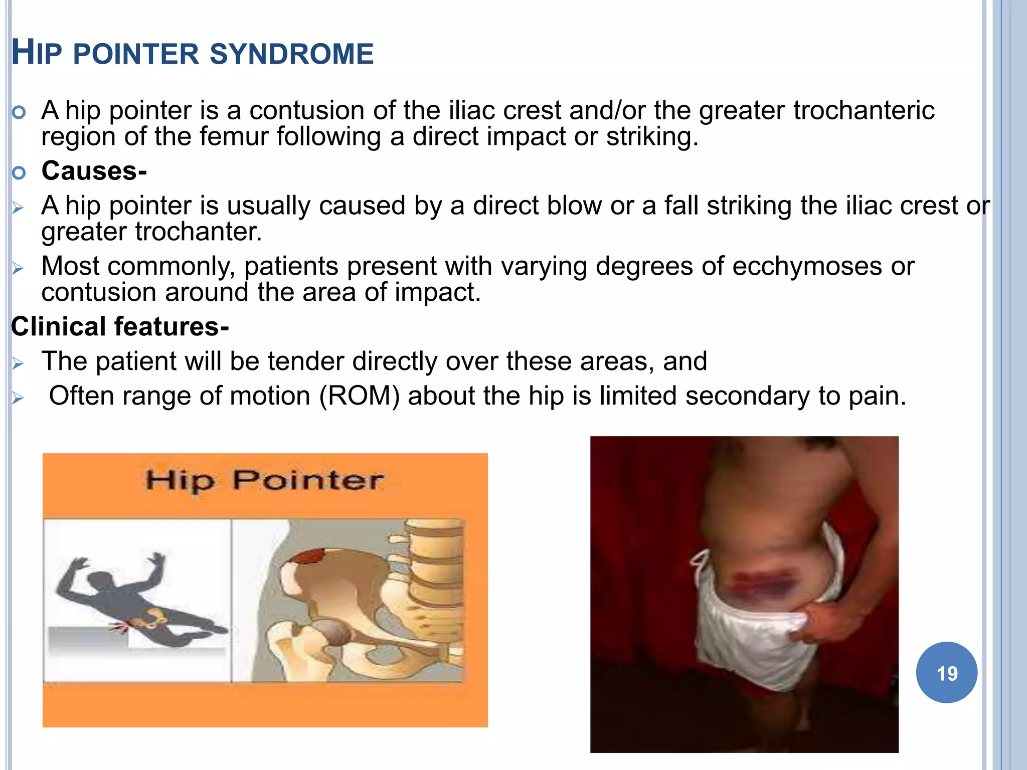 Differential diagnosis of hip | PPTX