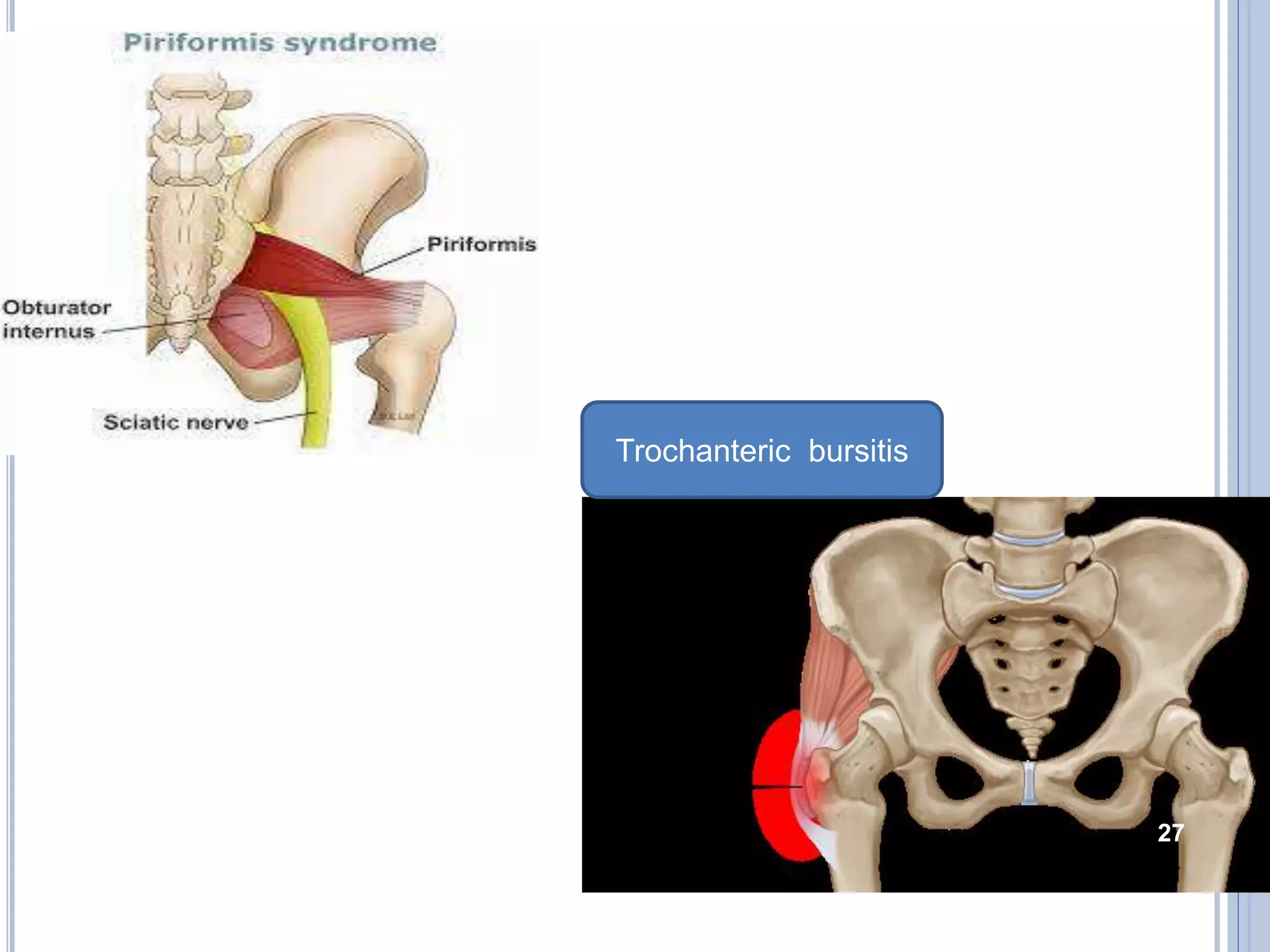 Differential diagnosis of hip | PPTX