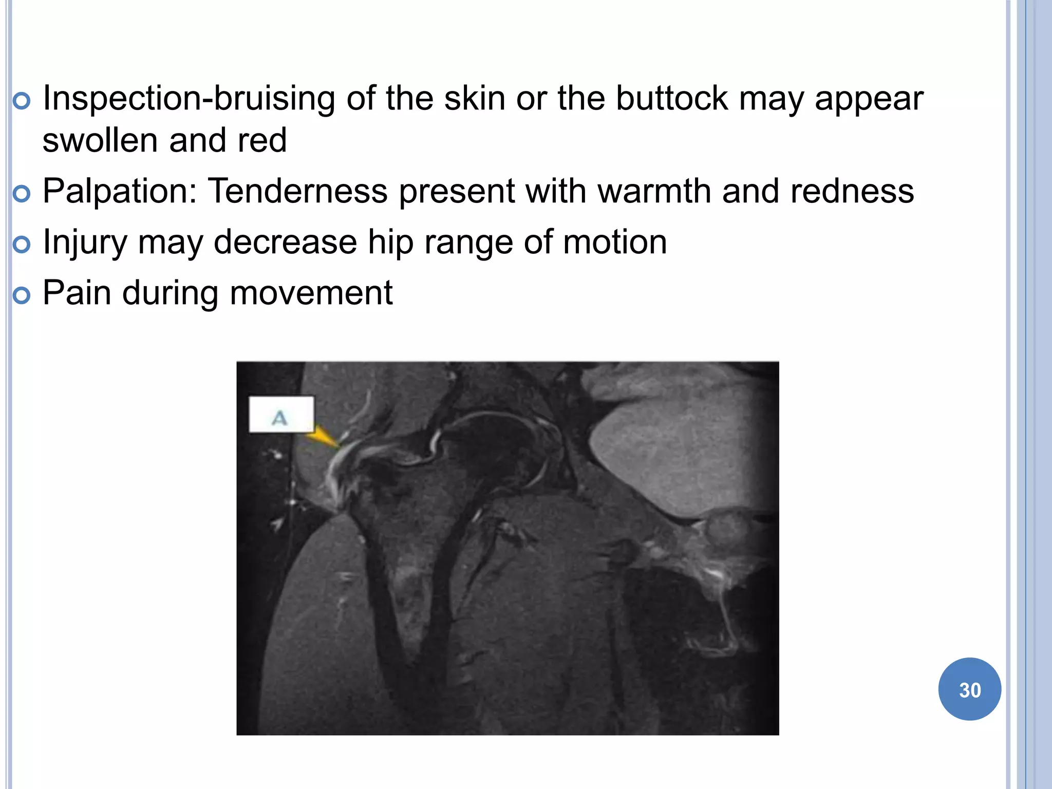Differential diagnosis of hip | PPTX
