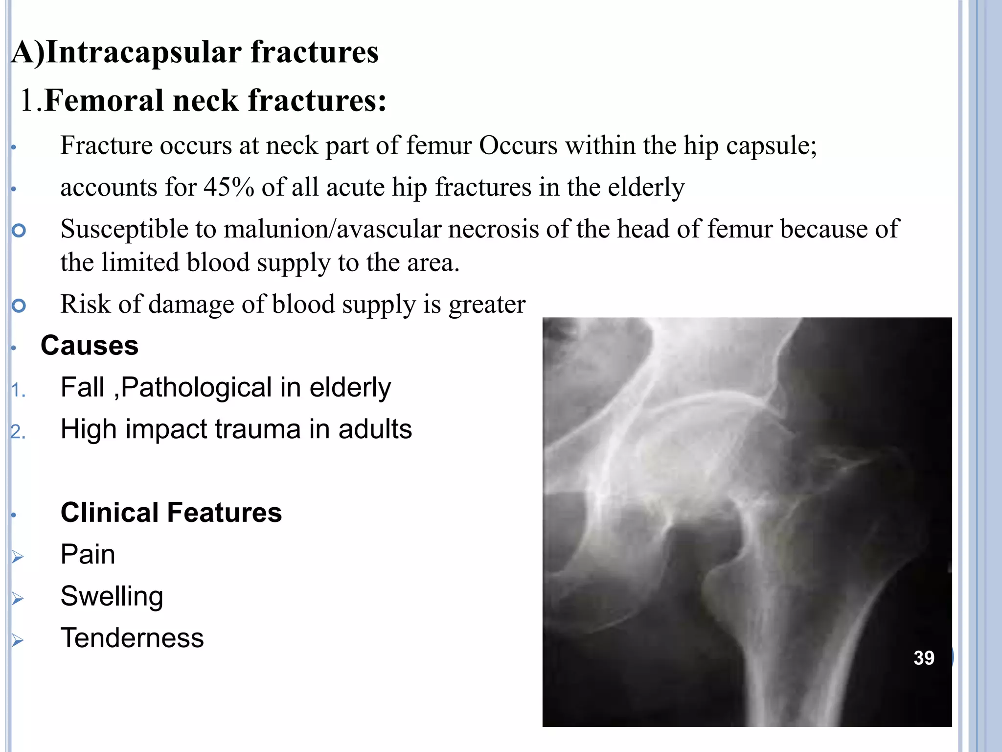 Differential diagnosis of hip | PPTX