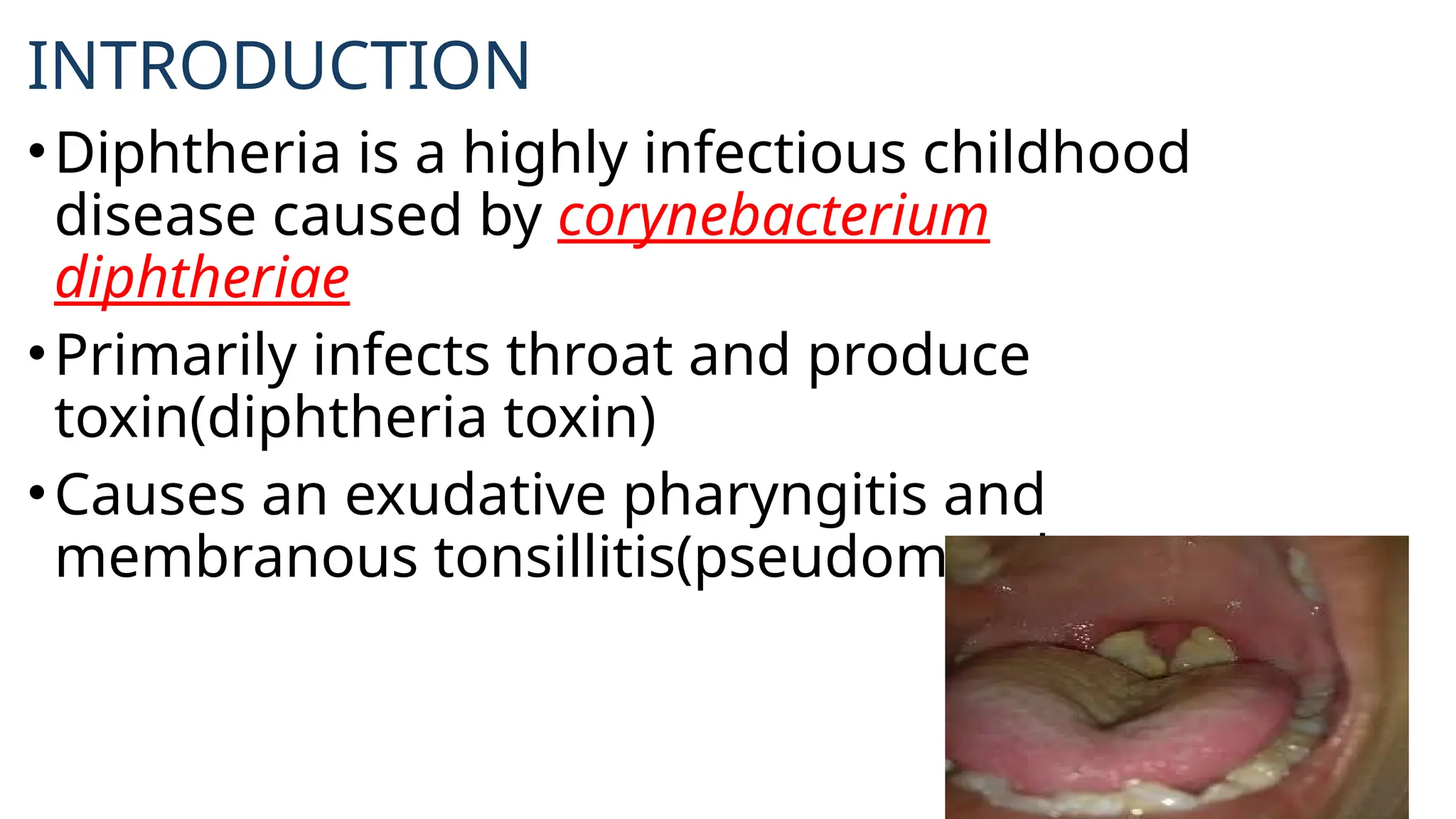 Diphtheria and it’s etiology microbiology MBBS | PPTX