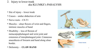 Brachial Plexus Injury and Nerve Injury. | PPTX