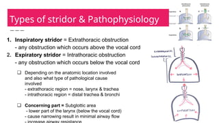 Seminar 2 - Acute stridor, causes, features and management | PPTX