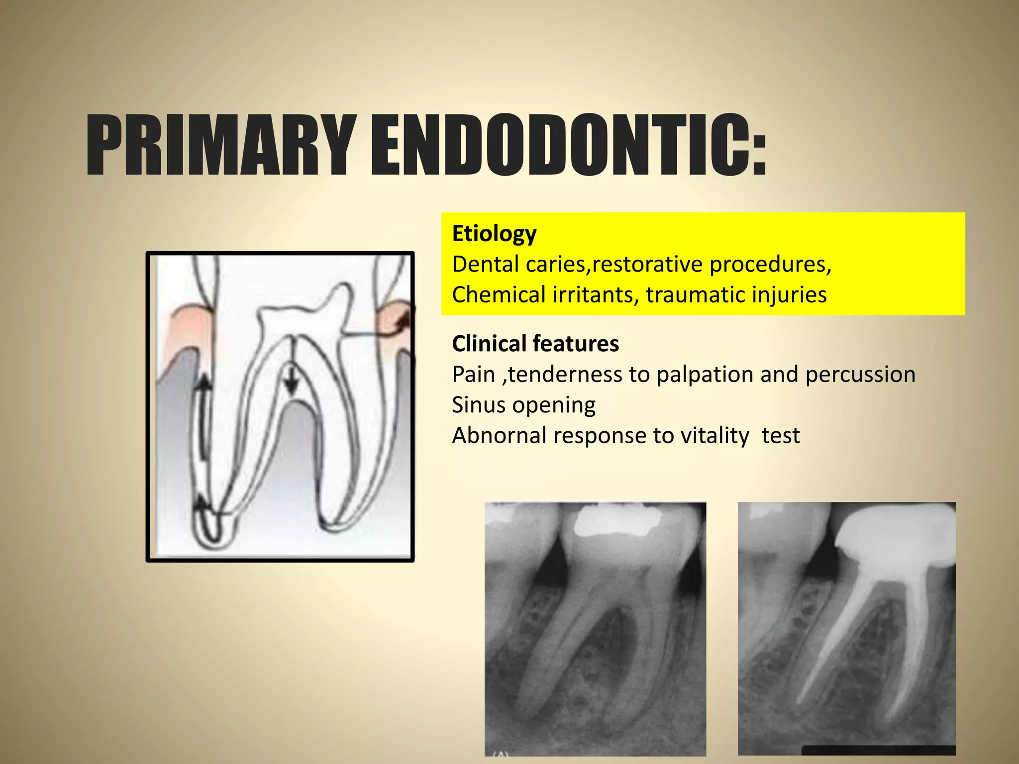 Endo - Perio lesions | PPTX