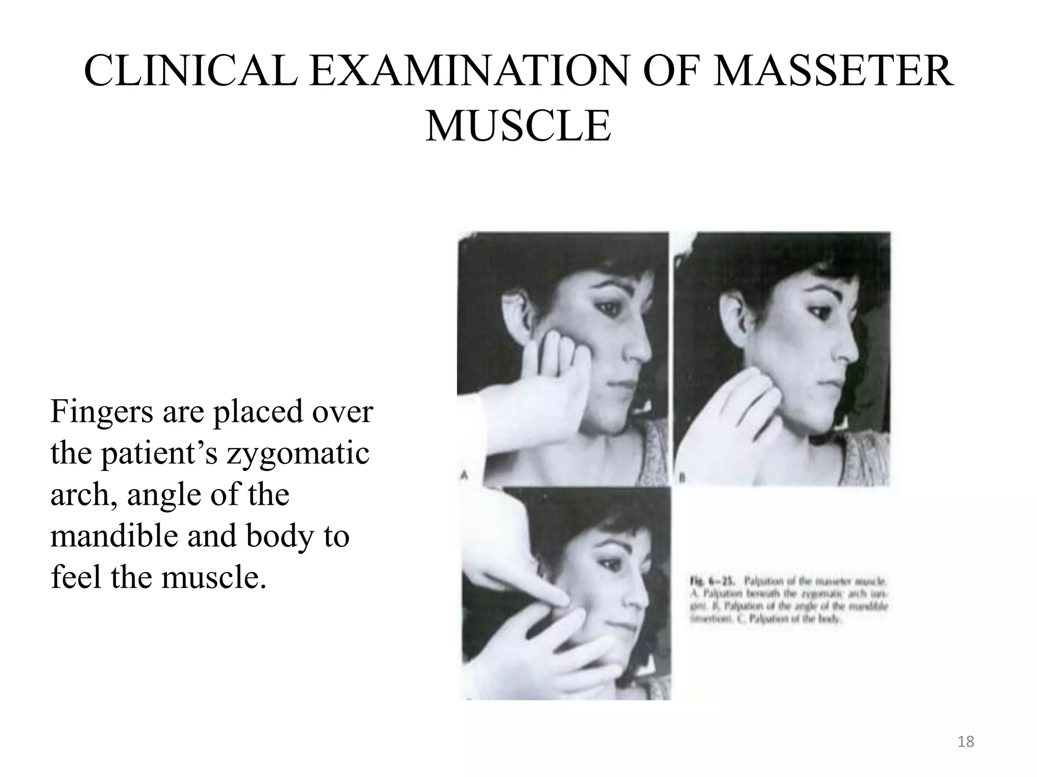 muscles of mastication | PPT