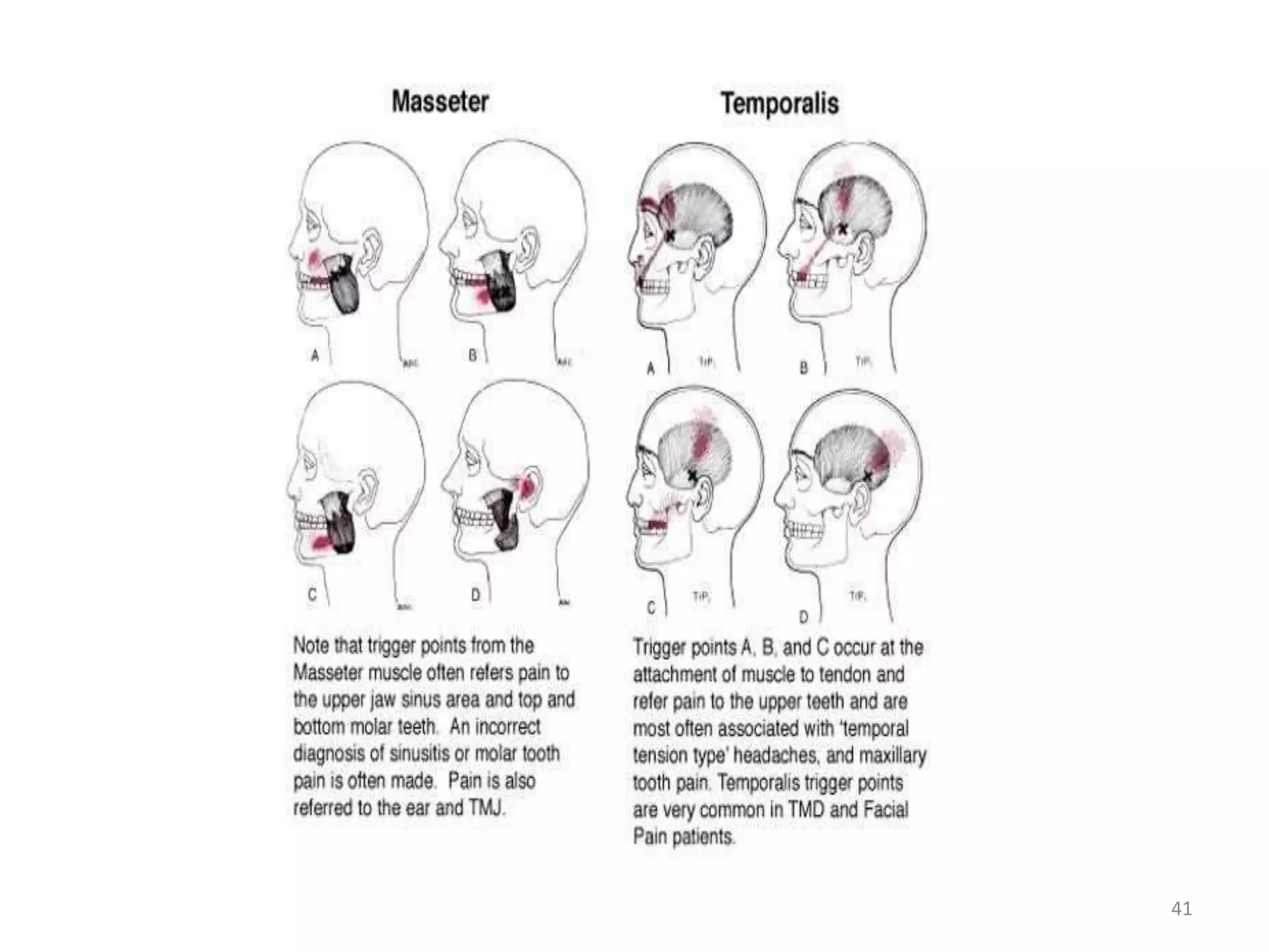 muscles of mastication | PPT