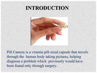 Pill Camera Technology | PPTX