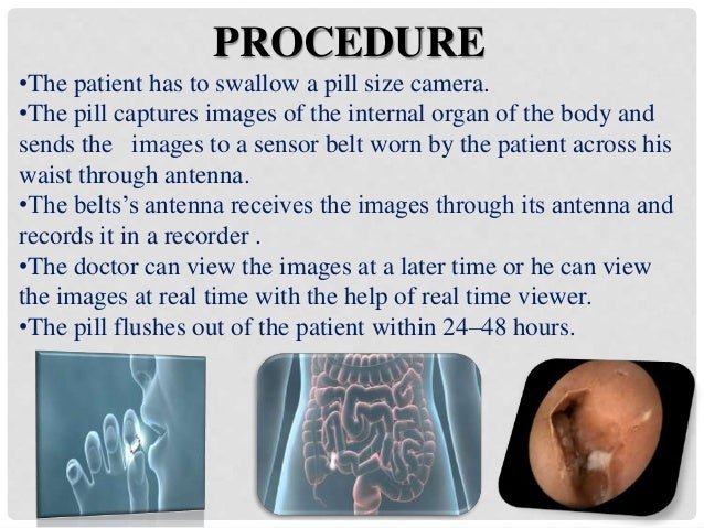 Pill Camera Technology
