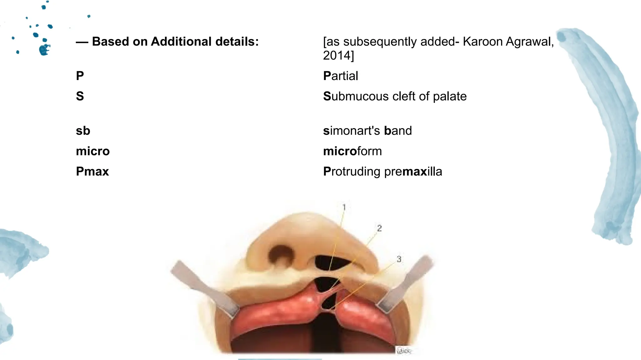 SEMINAR 27 - CLEFT PALATE and it's management.pptx