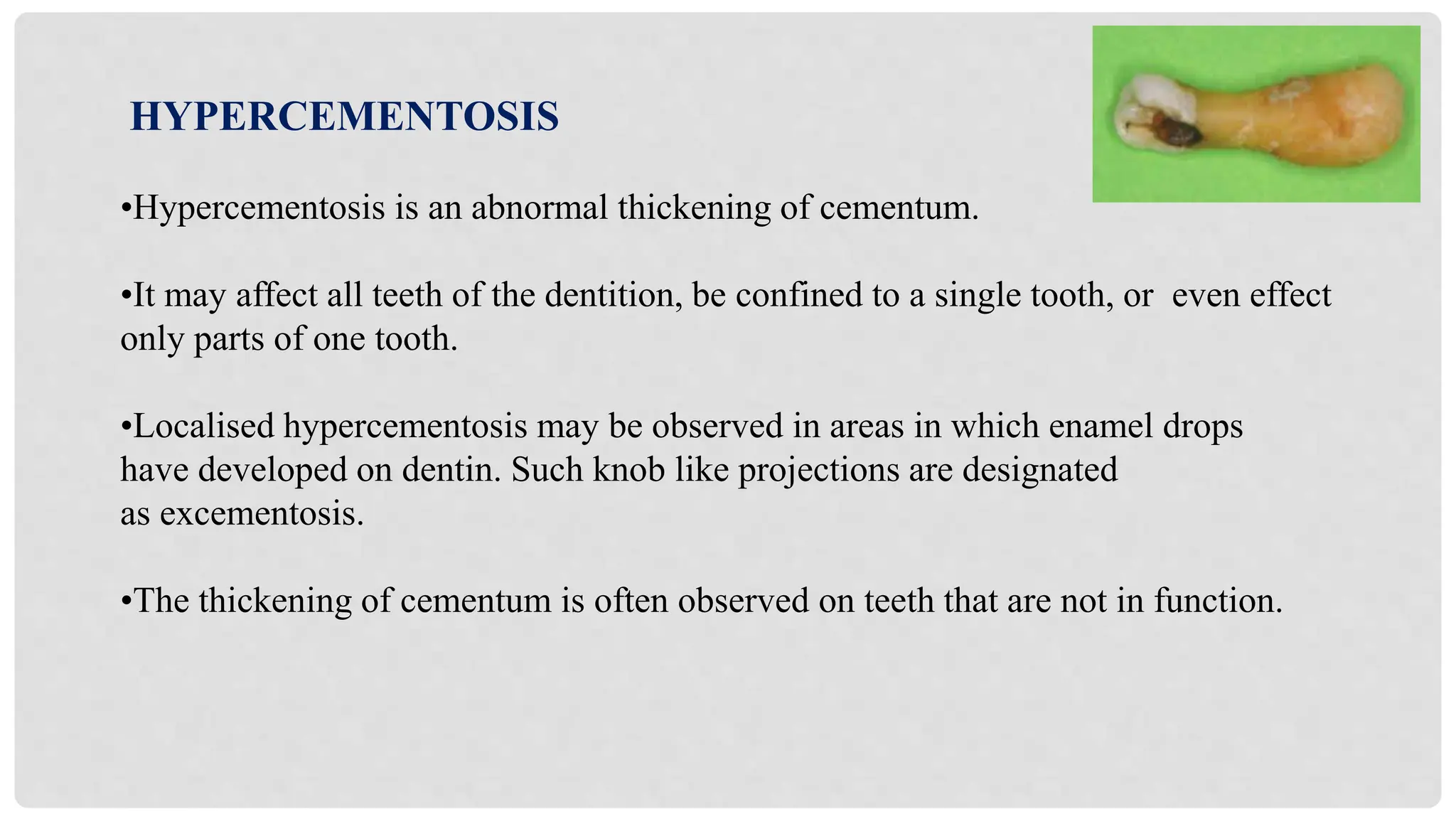 cementum | PPTX