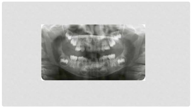 cementum | PPTX | Dental Health | Diseases and Conditions