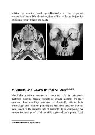 Growth rotations | DOCX
