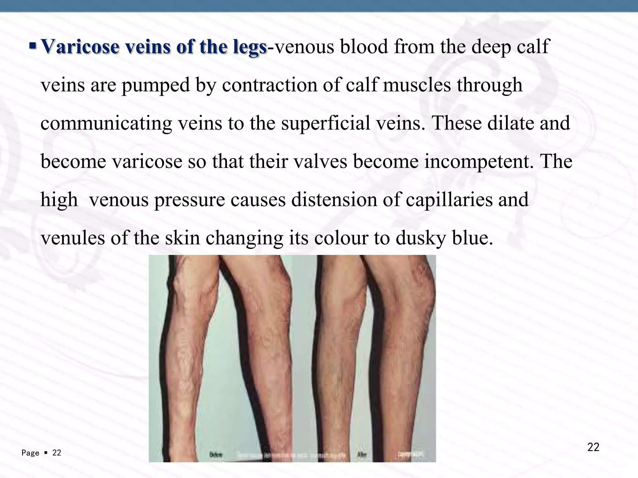 Ischemia and Infarction | PPTX