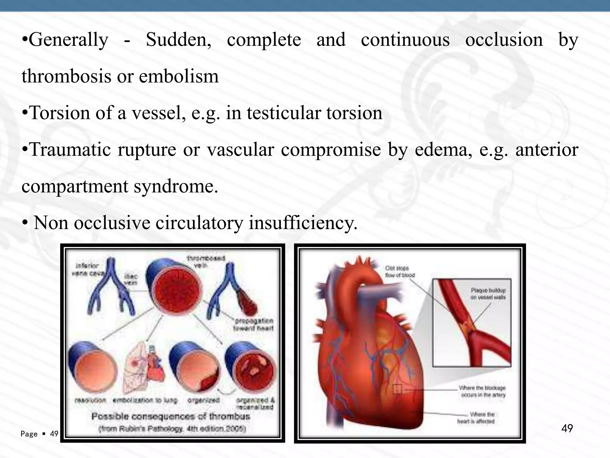 Ischemia and Infarction | PPTX