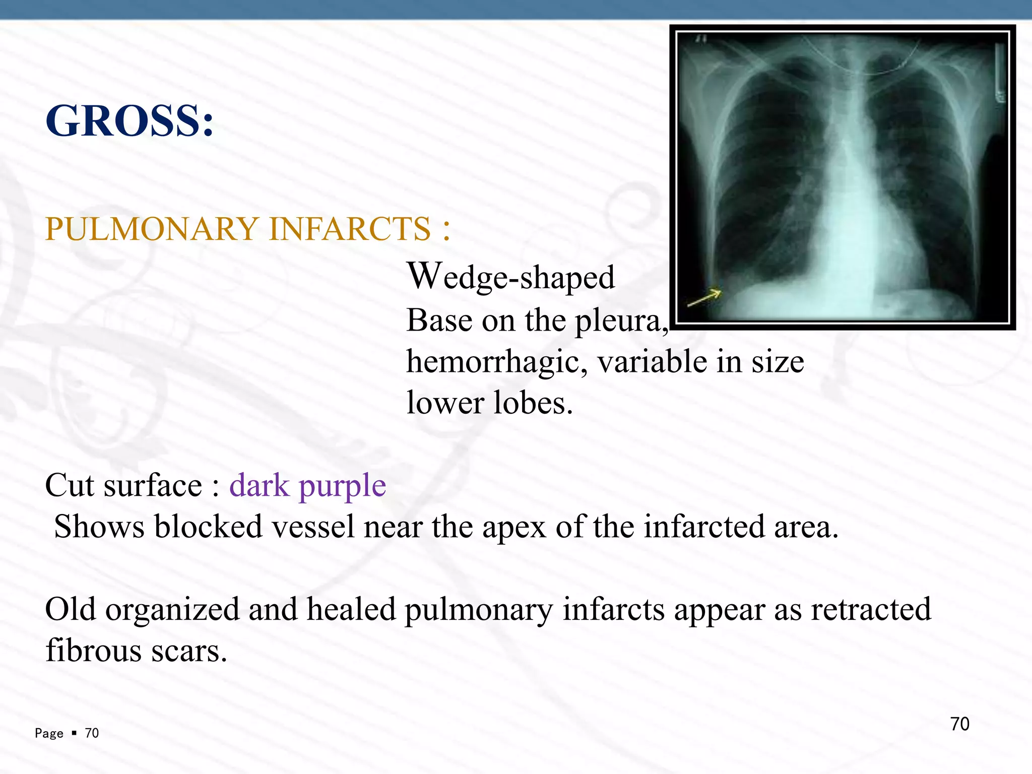Ischemia and Infarction | PPTX