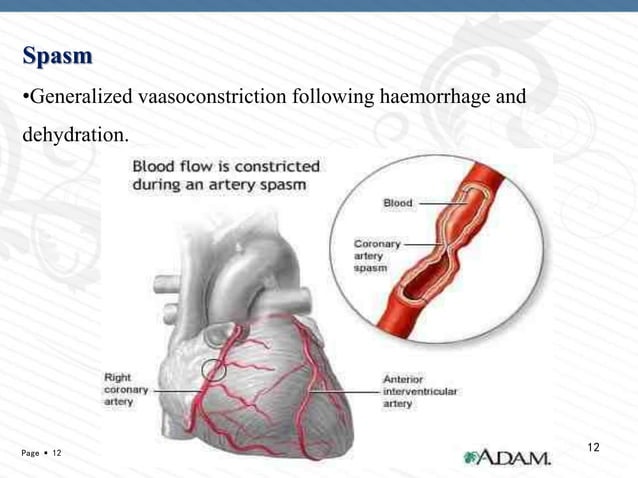 Ischemia and Infarction | PPTX | Blood Disorders | Diseases and Conditions
