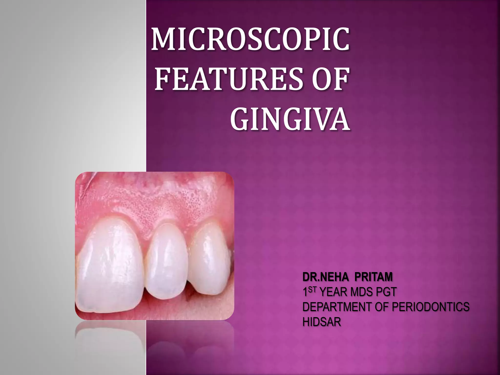 Microscopic features of gingiva. | PPTX