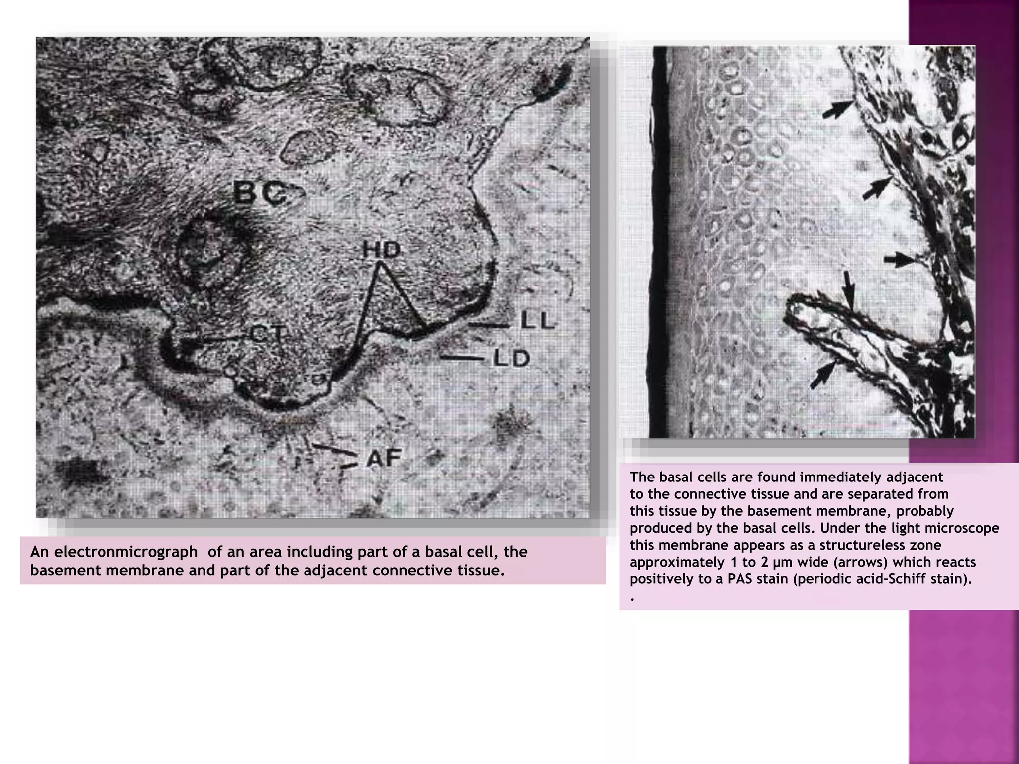 Microscopic features of gingiva. | PPTX