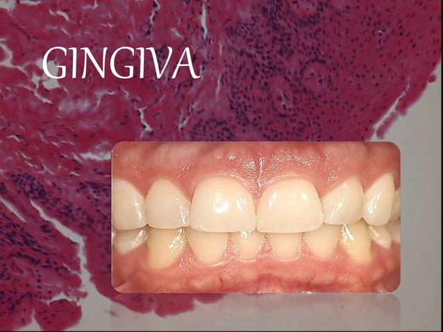 Microscopic features of gingiva. | PPTX