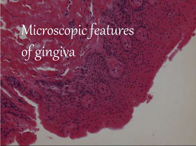 Microscopic features of gingiva. | PPTX
