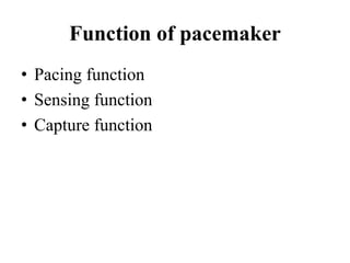 Pacemaker | PPTX