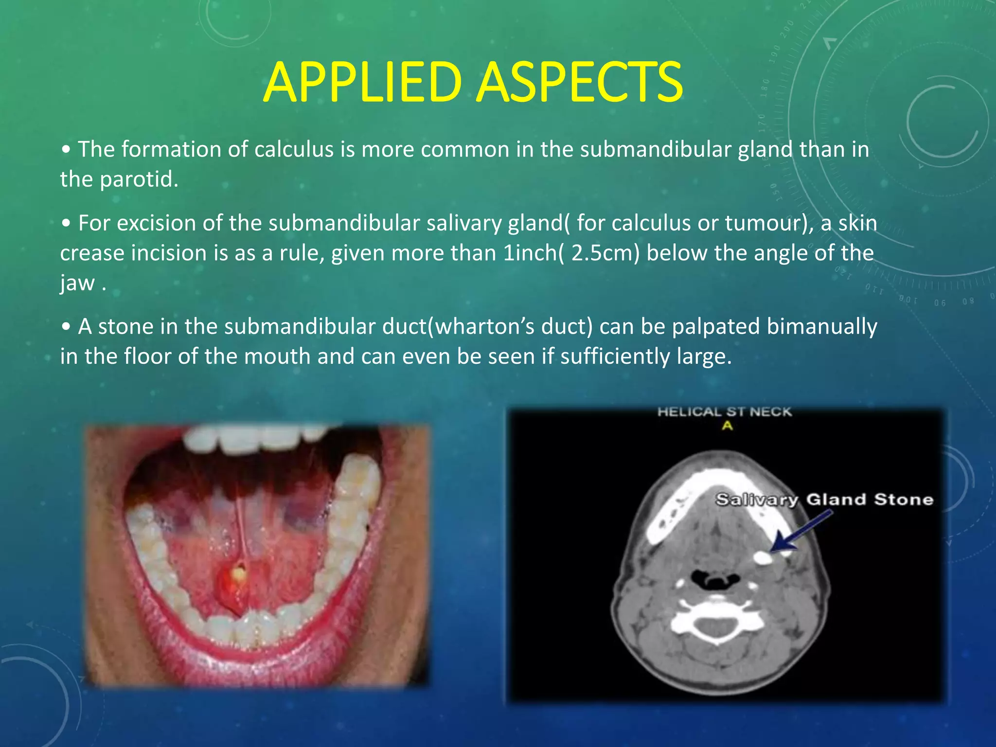 Surgical Anatomy of Salivary Glands and its Applied aspects | PPTX