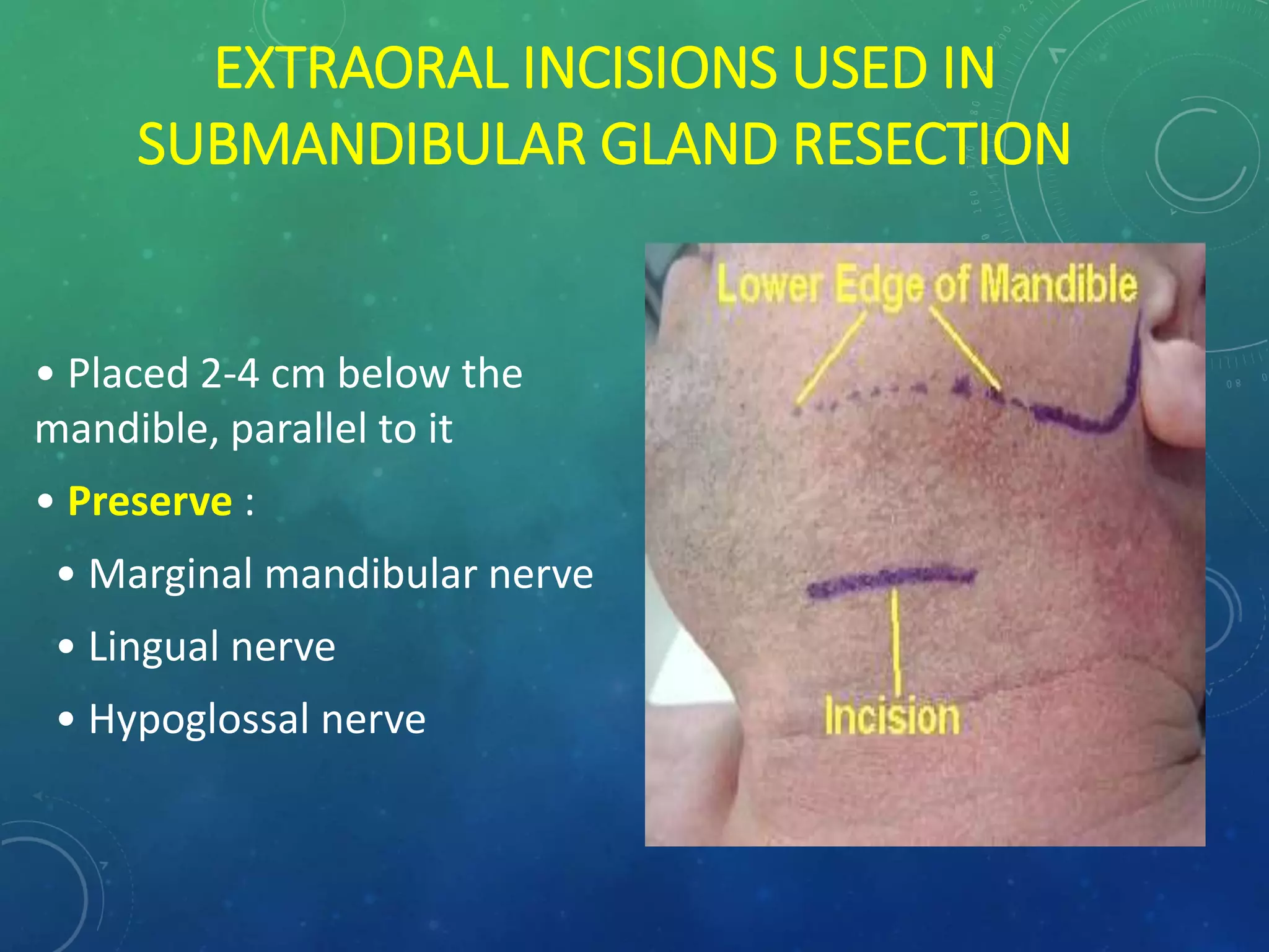 Surgical Anatomy of Salivary Glands and its Applied aspects | PPTX