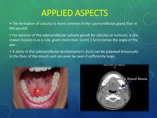 Surgical Anatomy of Salivary Glands and its Applied aspects | PPTX