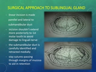 Surgical Anatomy of Salivary Glands and its Applied aspects | PPTX