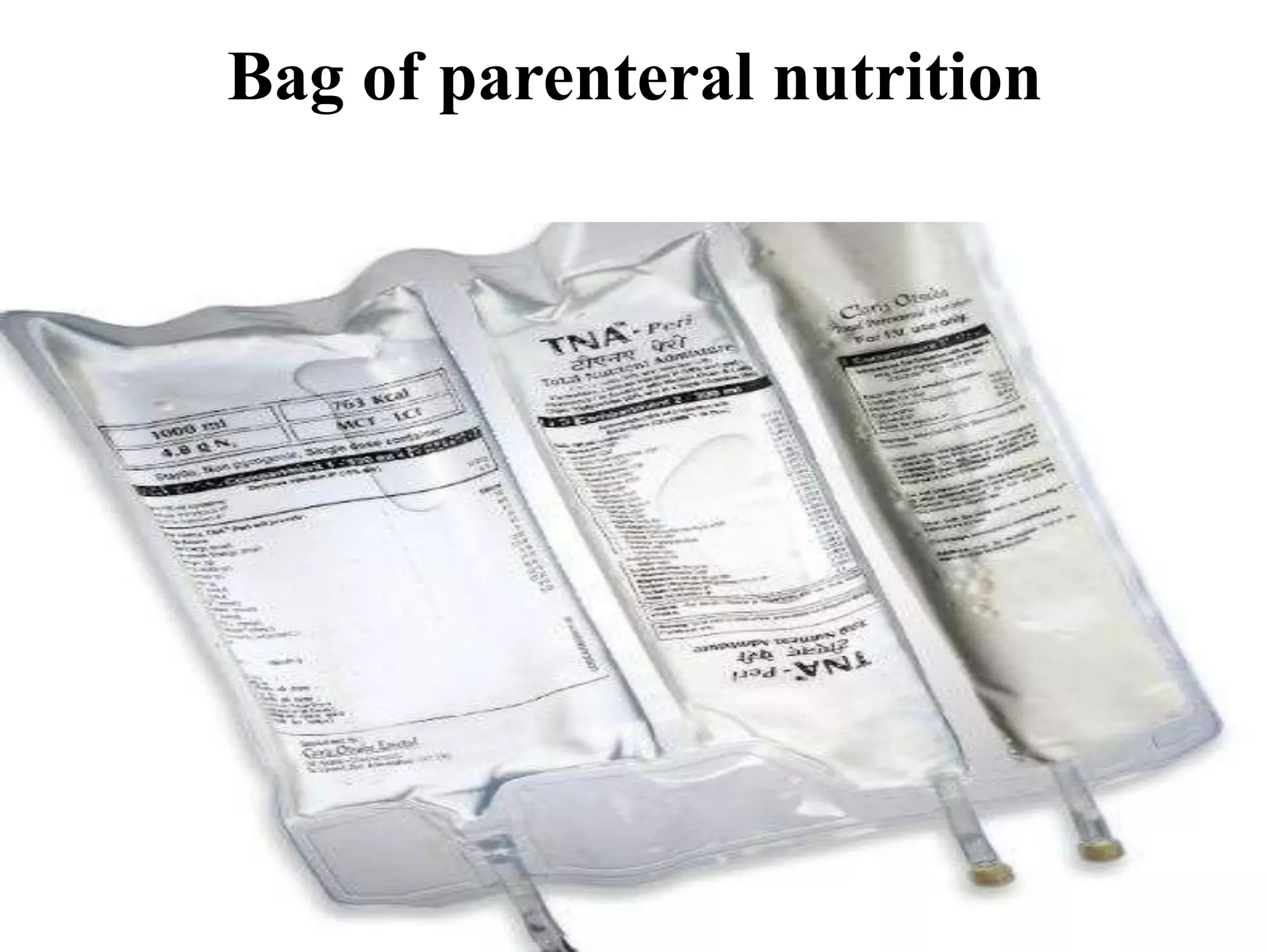 TOTAL PARENTERAL NUTRITION | PPTX