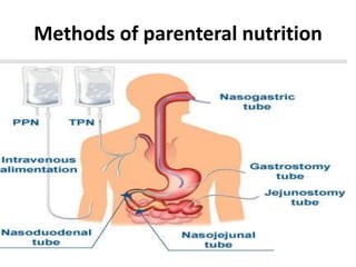 TOTAL PARENTERAL NUTRITION | PPTX