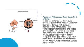 Clinical examination of nose in out patient setup | PPTX