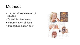 Clinical examination of nose in out patient setup | PPTX