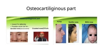 Clinical examination of nose in out patient setup | PPTX