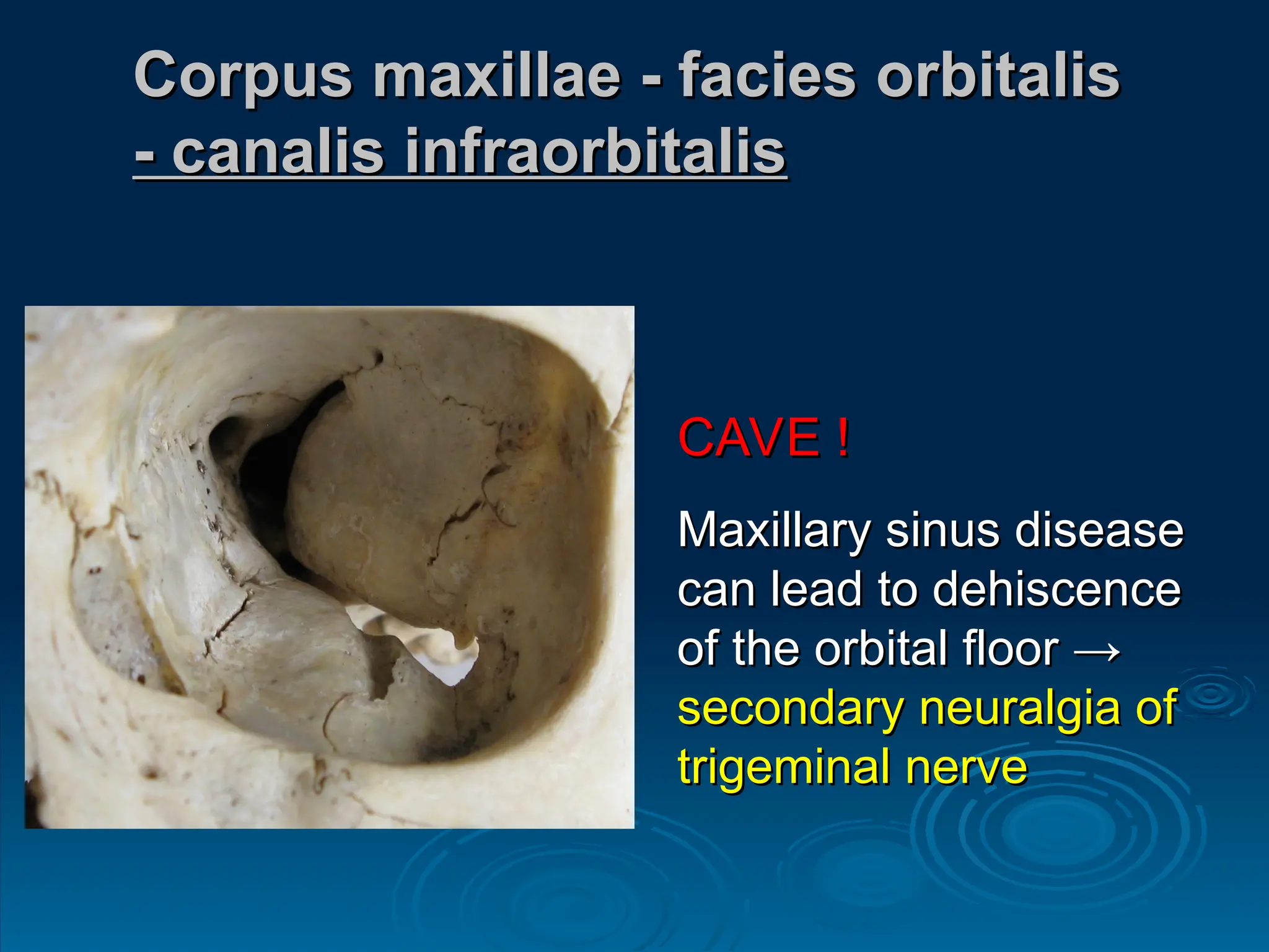 Seminar 3 Anatomy of Maxilla, growth blood supply | PPT