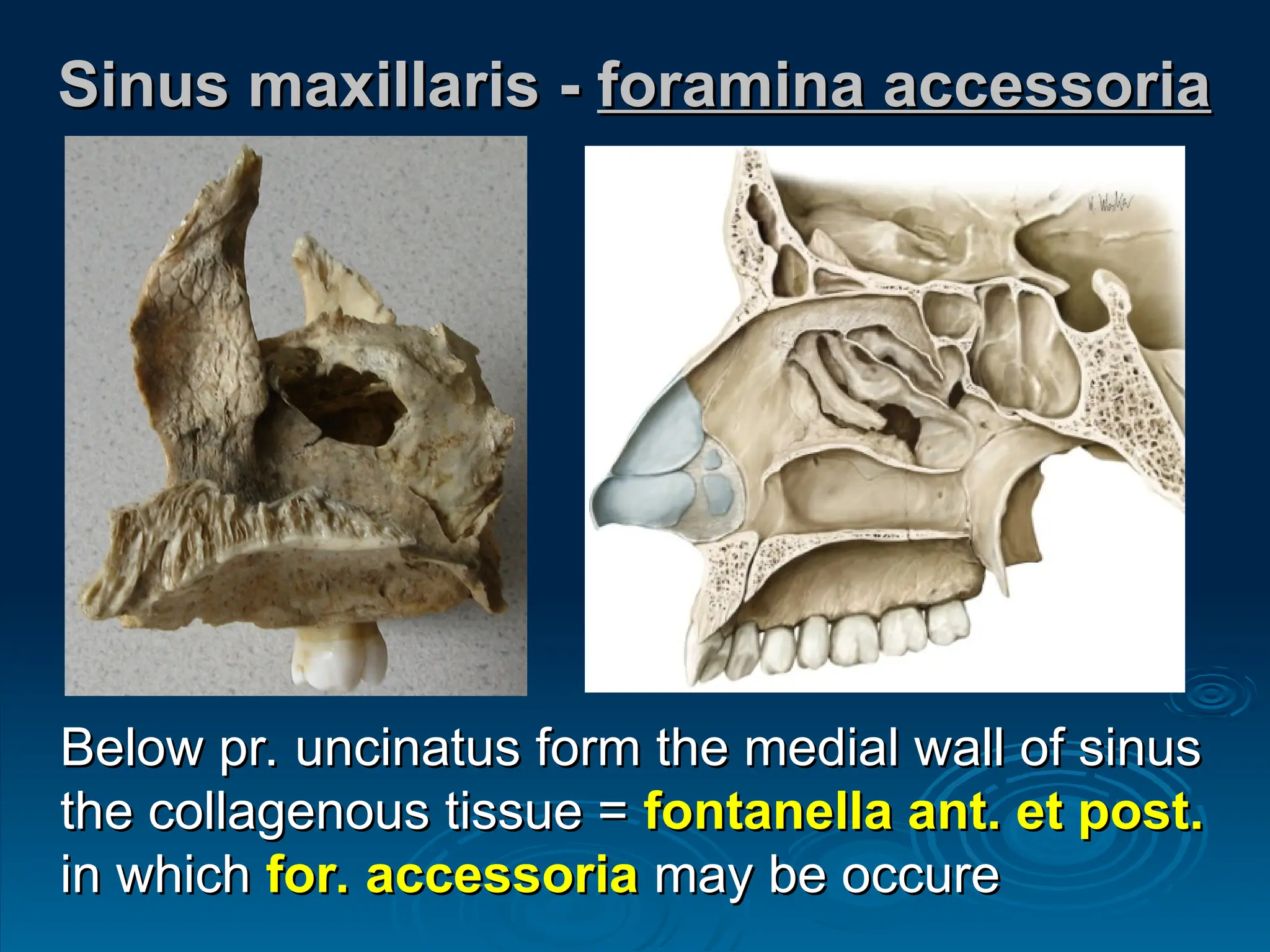 Seminar 3 Anatomy of Maxilla, growth blood supply | PPT