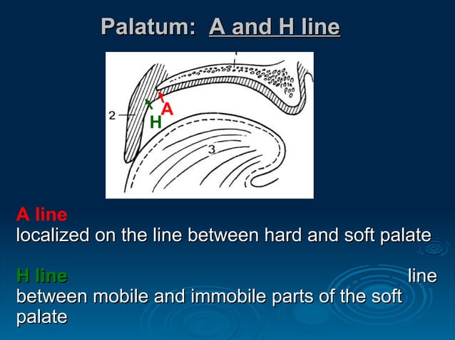 Seminar 3 Anatomy of Maxilla, growth blood supply | PPT | Bone and ...