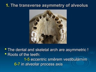Seminar 3 Anatomy of Maxilla, growth blood supply | PPT