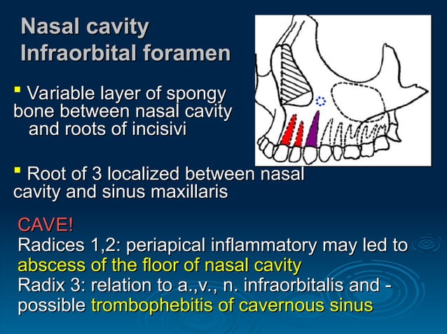 Seminar 3 Anatomy of Maxilla, growth blood supply | PPT | Bone and ...